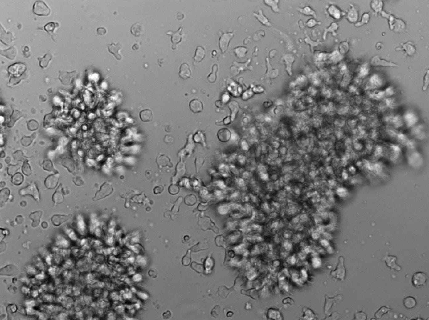 VFA Accumulation in Anaerobic Treatment: Causes and Risks